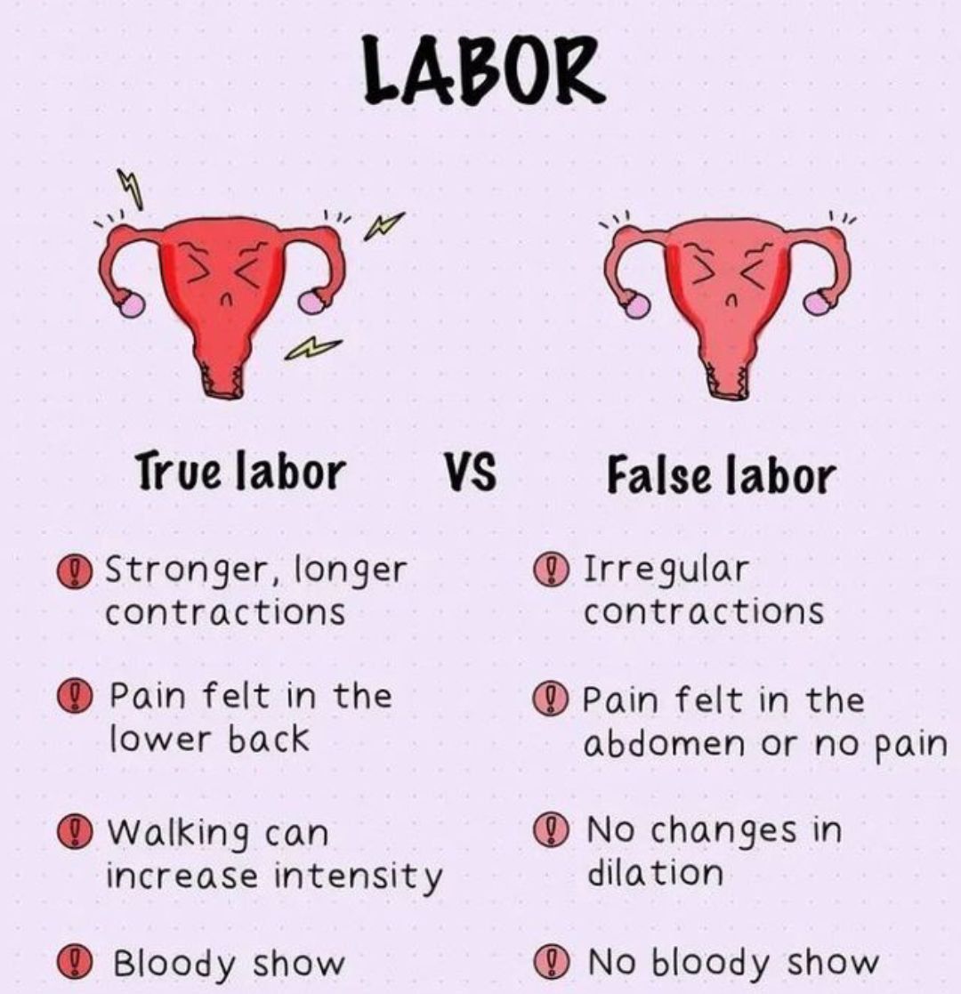 Shreyash Jaiswal on LinkedIn: #laborpain #labor #truelabor #falselabor ... Shreyash Jaiswal on LinkedIn: #laborpain #labor #truelabor #falselabor ...