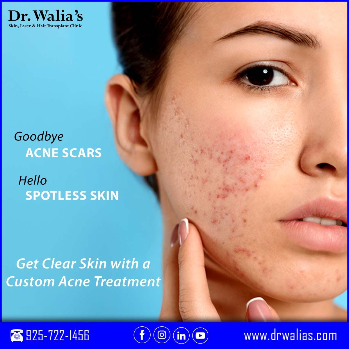 Dr. Walia's Skin, Laser & Hair Transplant Clinic on LinkedIn: # ... Dr. Walia's Skin, Laser & Hair Transplant Clinic on LinkedIn: # ...