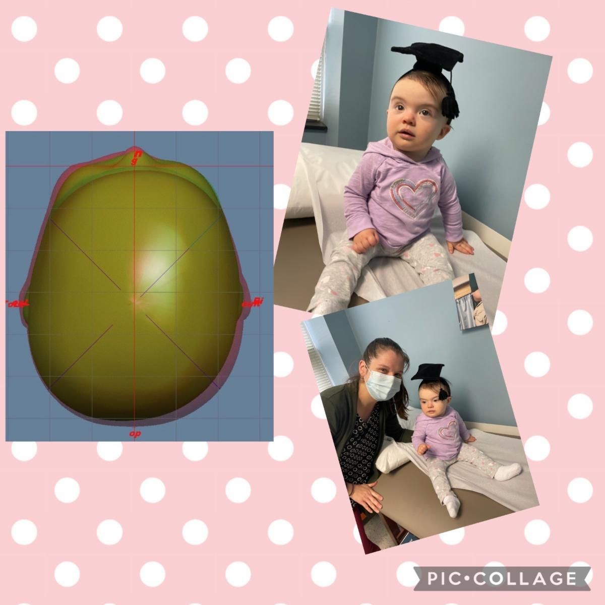 #kidcap #infinitetech #kidcap #cranialremoldinghelmet #plagiocephaly ... #kidcap #infinitetech #kidcap #cranialremoldinghelmet #plagiocephaly ...