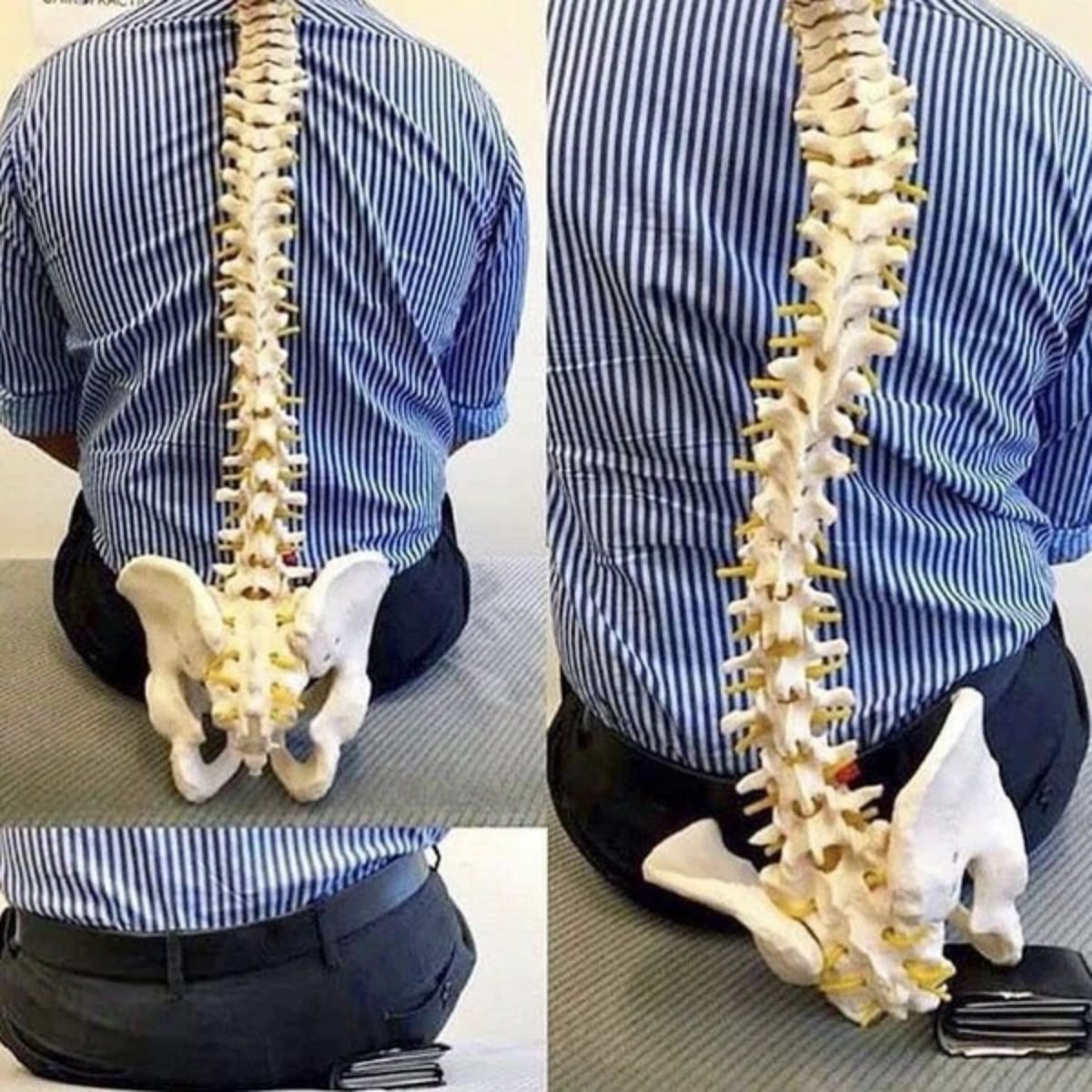 Manila Bajimaya on LinkedIn: Please don't neglect your postureš§ Manila Bajimaya on LinkedIn: Please don't neglect your postureš§