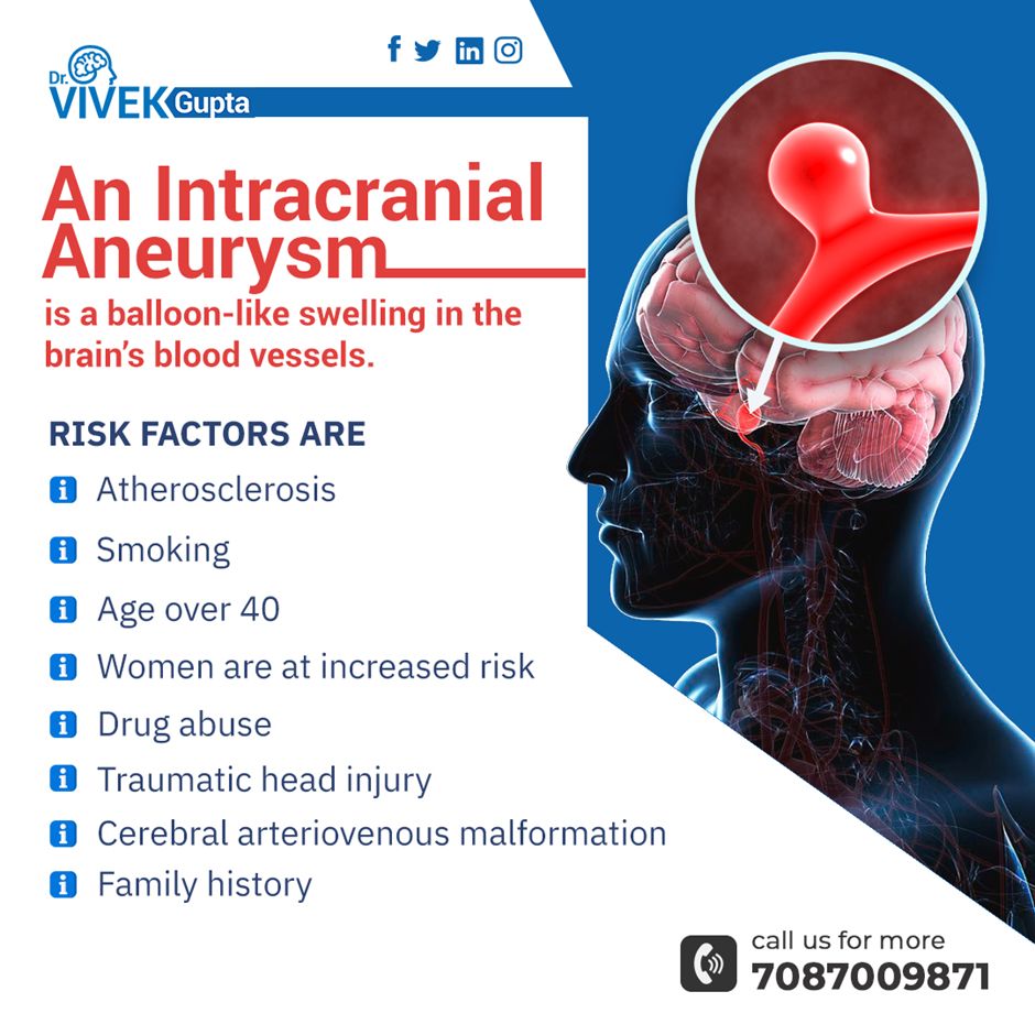 Dr. Vivek Gupta LinkedIn‘de: #intracranialaneurysm #atherosclerosis # ... Dr. Vivek Gupta LinkedIn‘de: #intracranialaneurysm #atherosclerosis # ...