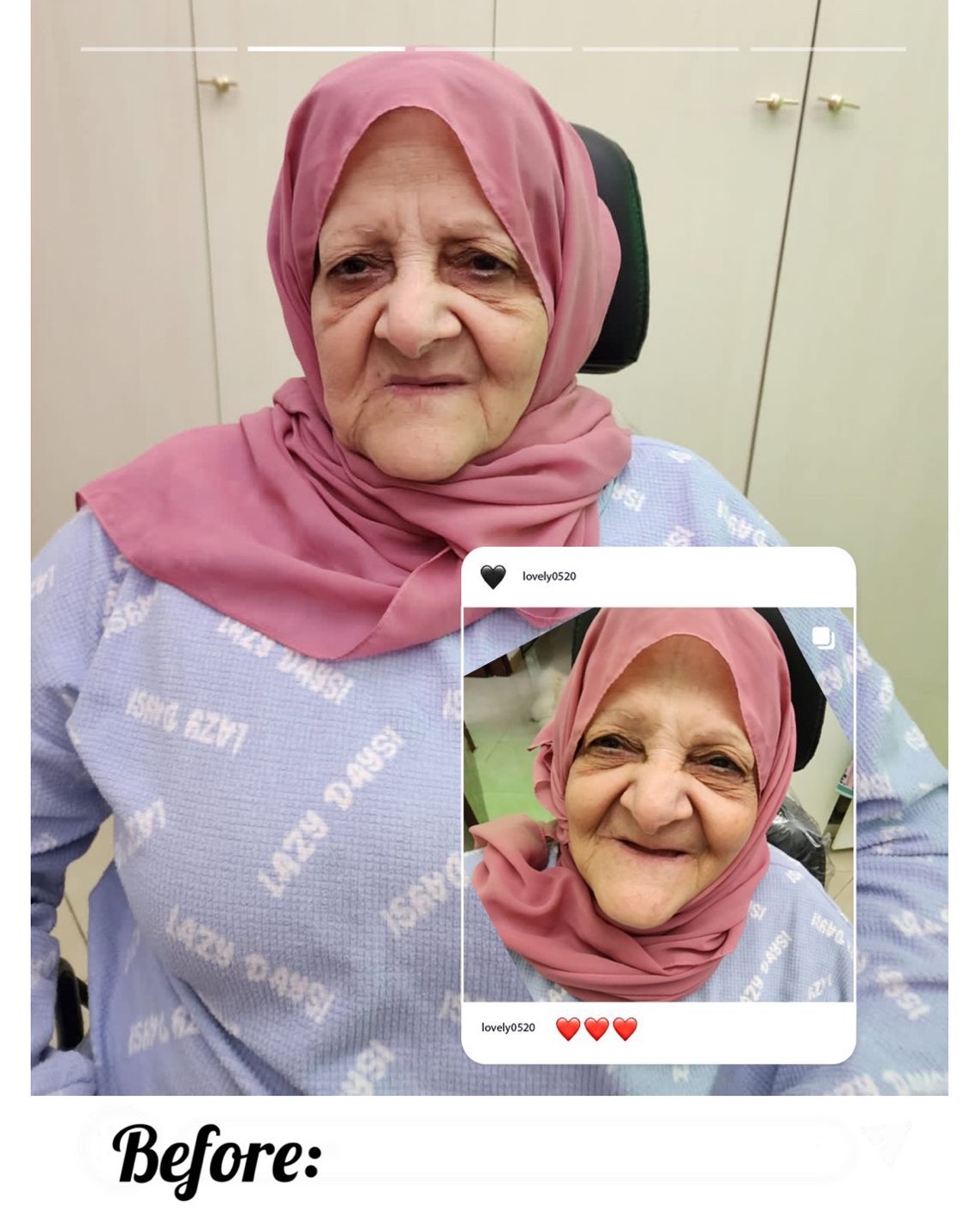 Nour Ararawi on LinkedIn: #dentist #dental #dentalanatomy #dentures # ... Nour Ararawi on LinkedIn: #dentist #dental #dentalanatomy #dentures # ...