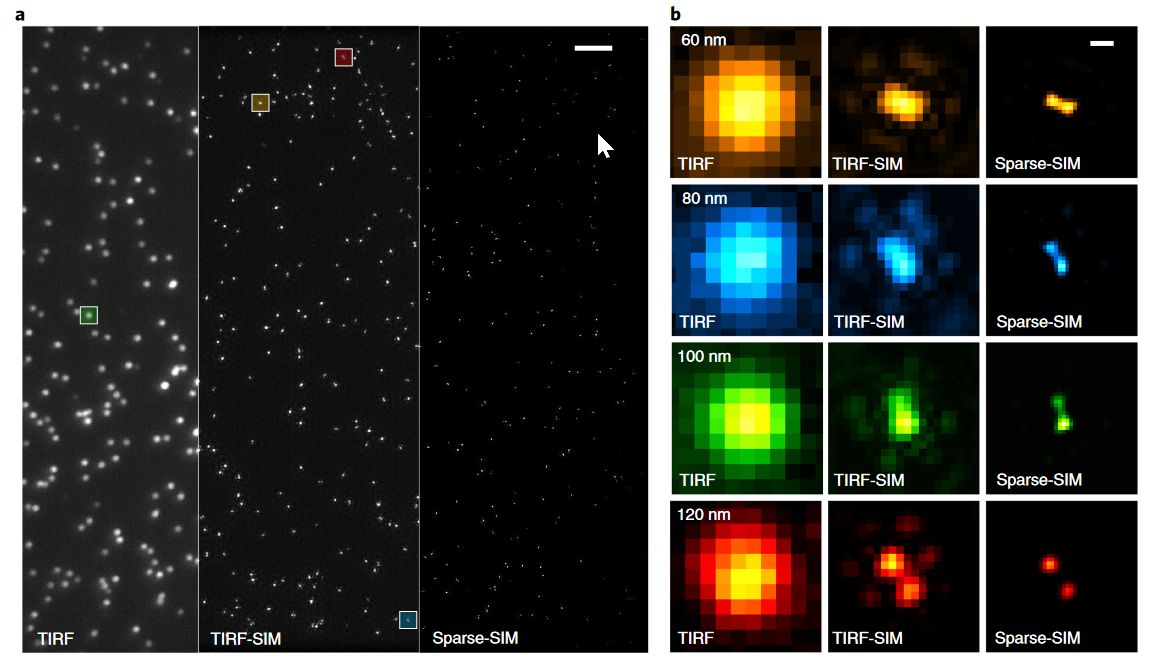 Volodymyr Nechyporuk-Zloy on LinkedIn: Sparse deconvolution improves ... Volodymyr Nechyporuk-Zloy on LinkedIn: Sparse deconvolution improves ...