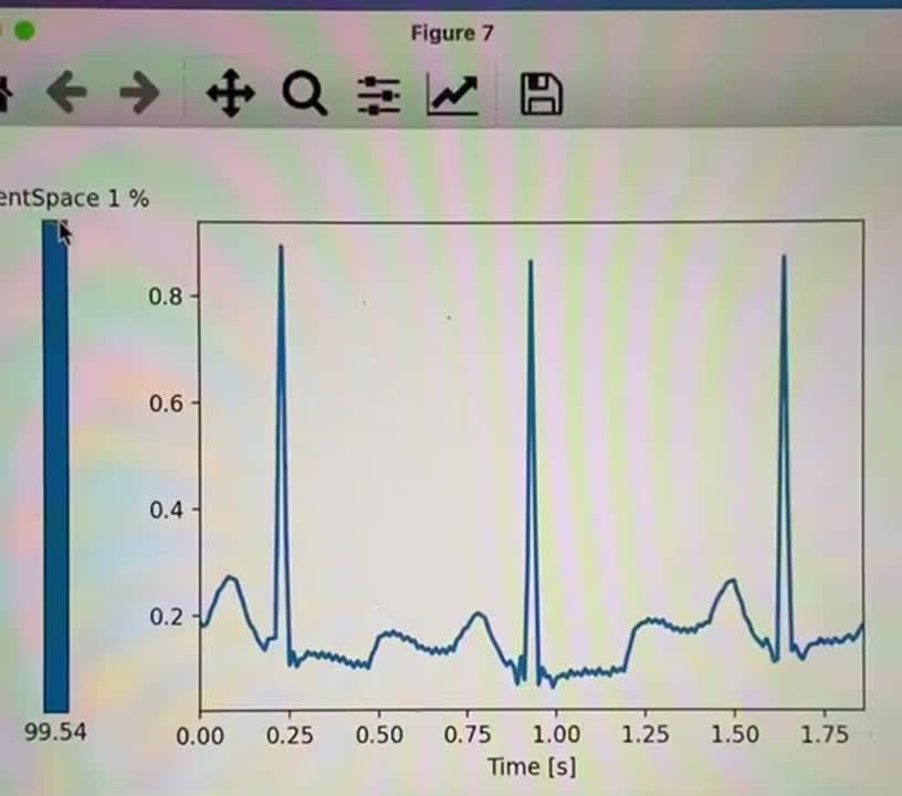 Denoising ECG using Neural Networks | Eoin Brophy Denoising ECG using Neural Networks | Eoin Brophy