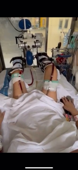 Tony Espinoza,MSN,RN,CCRN on LinkedIn: #ecmo #pt #rehab #keepfighting ... Tony Espinoza,MSN,RN,CCRN on LinkedIn: #ecmo #pt #rehab #keepfighting ...