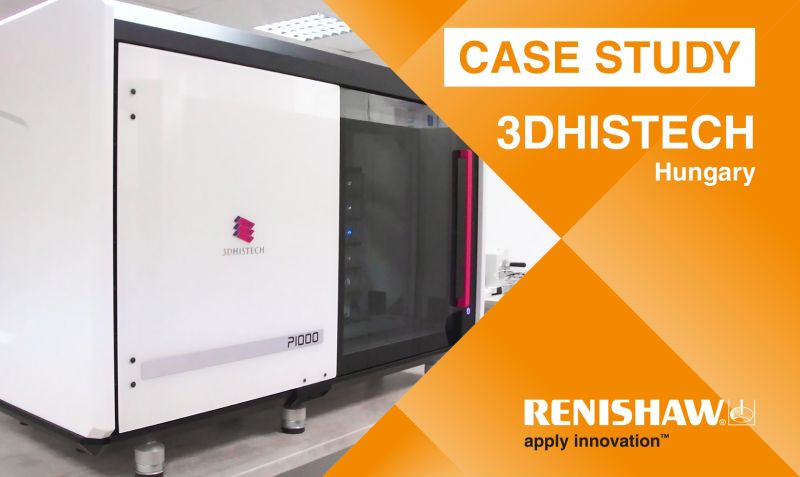 Renishaw Position Encoders on LinkedIn: #pathology #encoders # ... Renishaw Position Encoders on LinkedIn: #pathology #encoders # ...