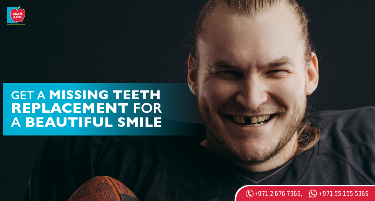 Replacing Missing Teeth? Here's What You Need to Know Replacing Missing Teeth? Here's What You Need to Know