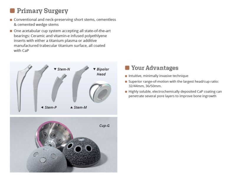 Recon-i on LinkedIn: Introducing Recon-i Primary Hip Reconstruction Recon-i on LinkedIn: Introducing Recon-i Primary Hip Reconstruction
