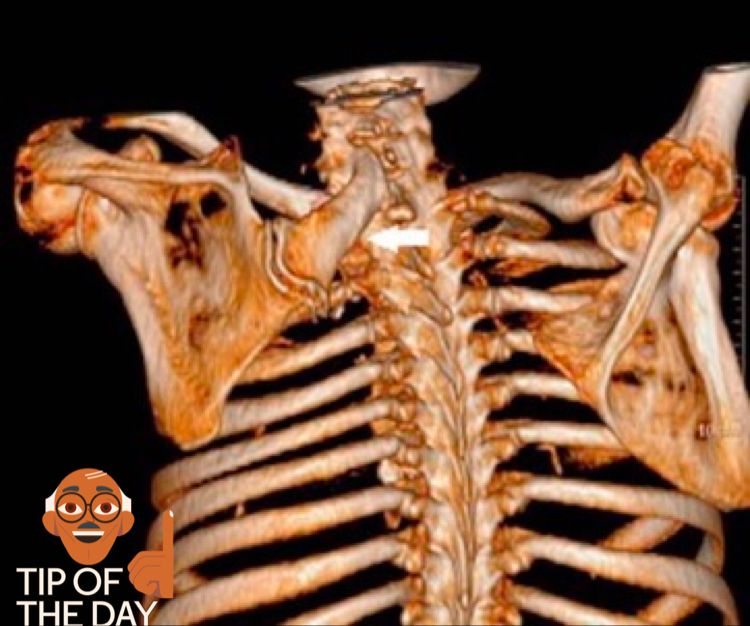 Mohamed Shemais on LinkedIn: #musculoskeletal #deformity #orthopedics # ... Mohamed Shemais on LinkedIn: #musculoskeletal #deformity #orthopedics # ...