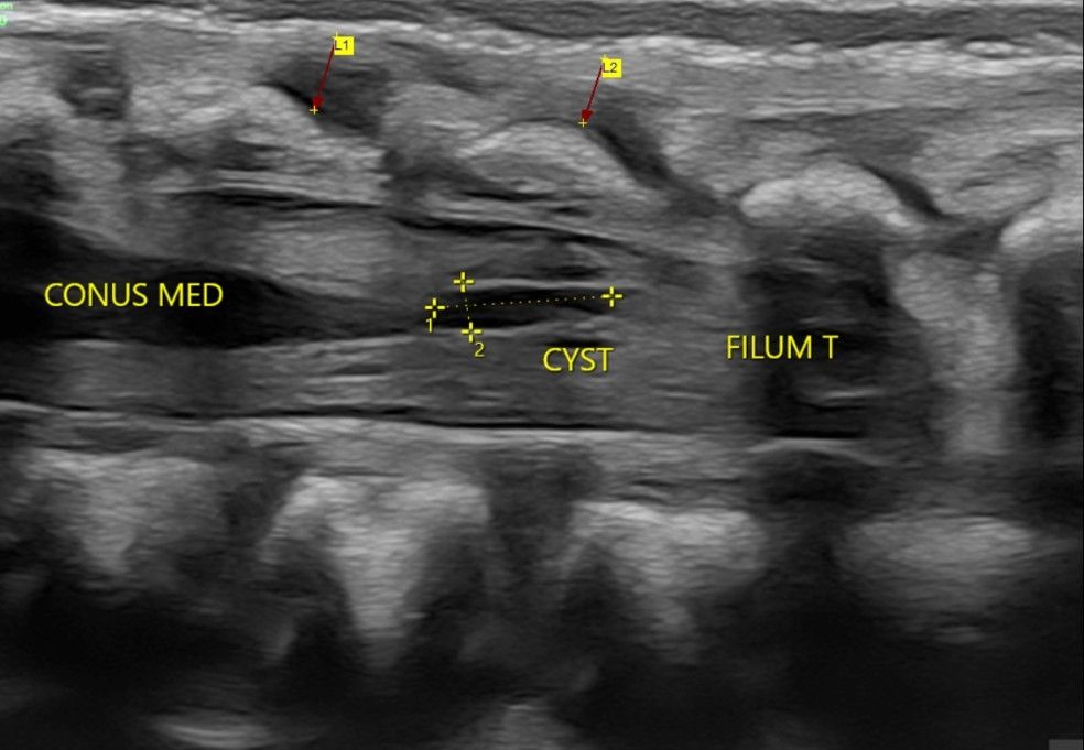 Mohamed Shemais on LinkedIn: #pediatric_imaging #neuroimaging # ... Mohamed Shemais on LinkedIn: #pediatric_imaging #neuroimaging # ...