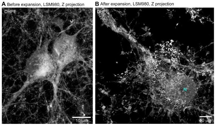 Expansion microscopy with trypsin digestion and tyramide signal ... Expansion microscopy with trypsin digestion and tyramide signal ...