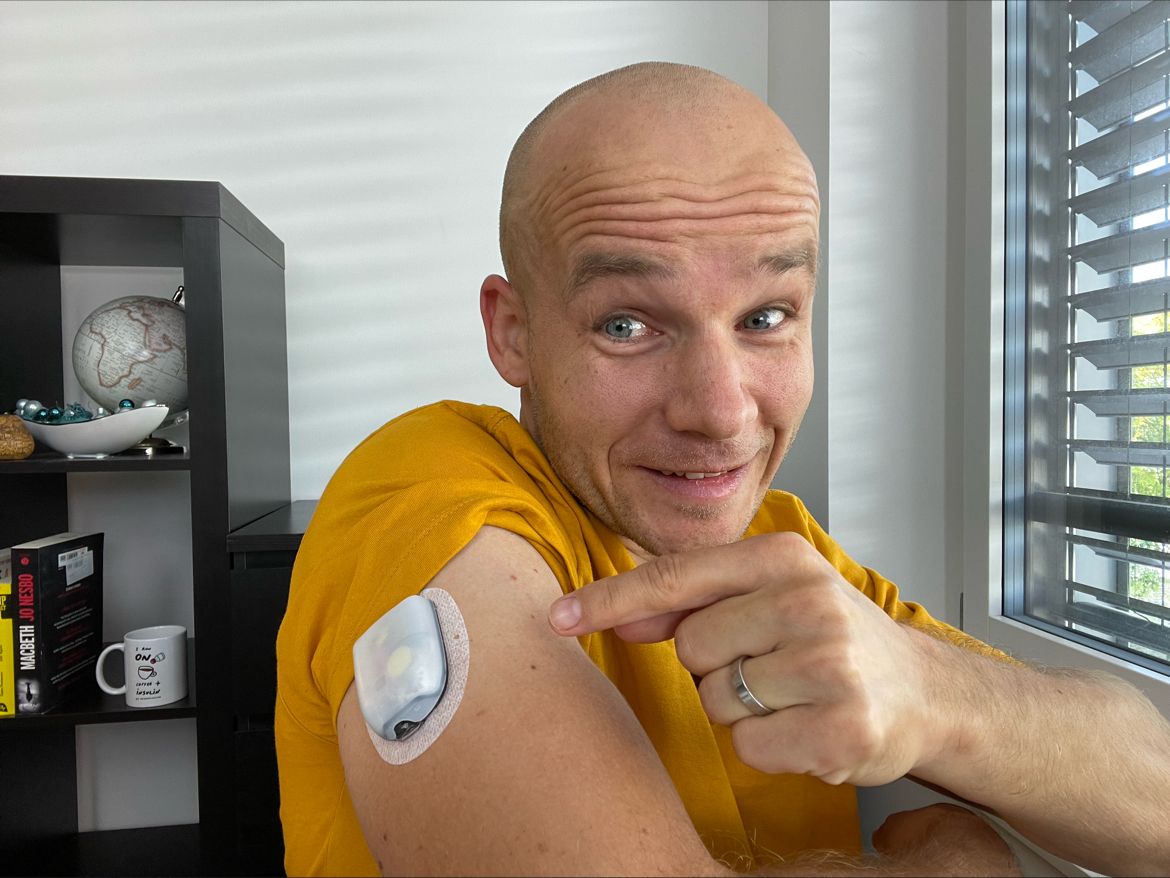 Tom Vesely on LinkedIn: #type1diabetes #omnipod5 #dexcom | 21 comments Tom Vesely on LinkedIn: #type1diabetes #omnipod5 #dexcom | 21 comments