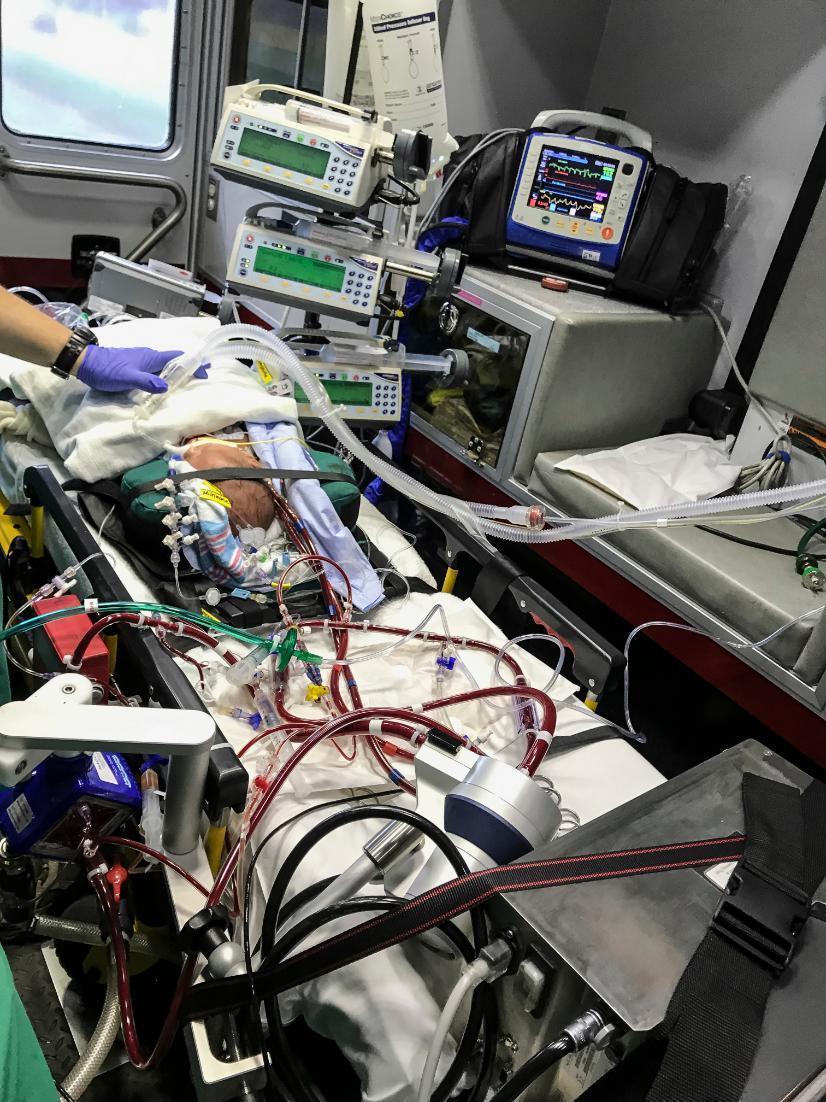 #ecls #ecmo | Innovative ECMO Concepts Inc. #ecls #ecmo | Innovative ECMO Concepts Inc.