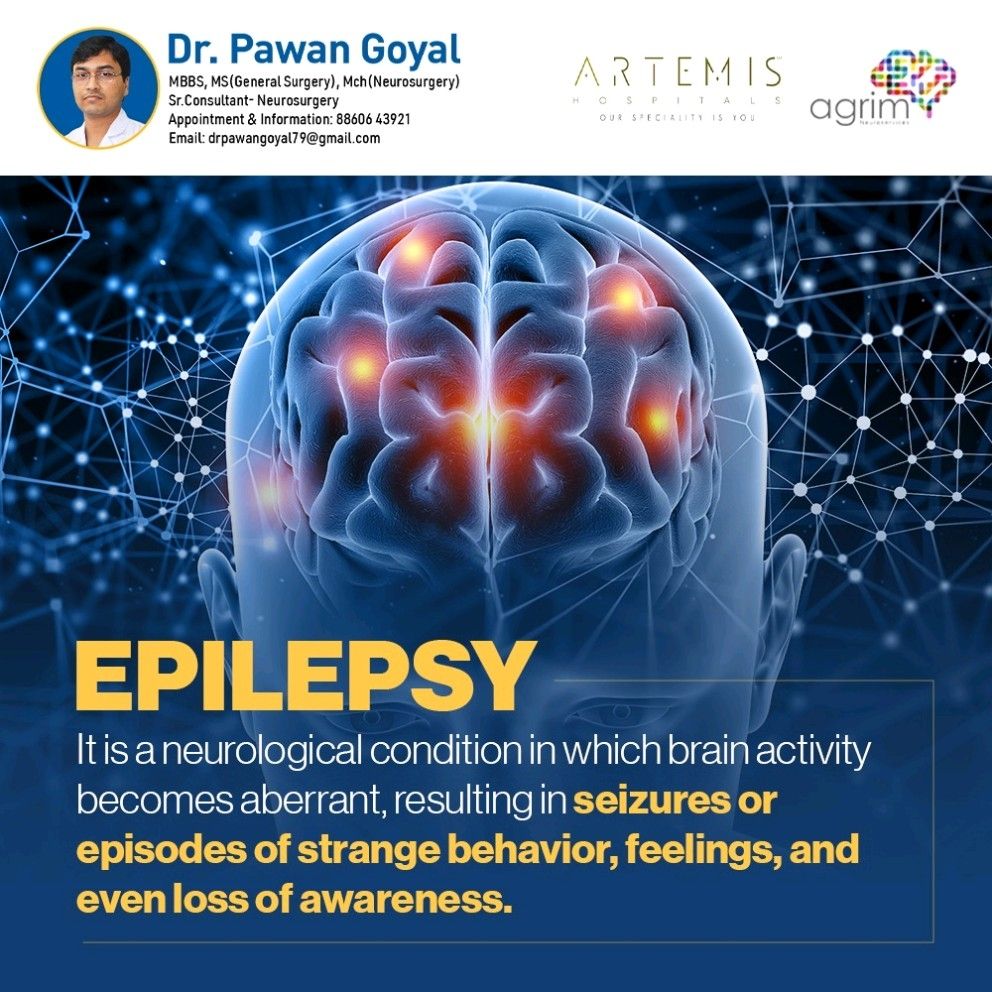 #epilepsy #epilepsyawareness #neurosurgery #neuroscience #awareness ... #epilepsy #epilepsyawareness #neurosurgery #neuroscience #awareness ...