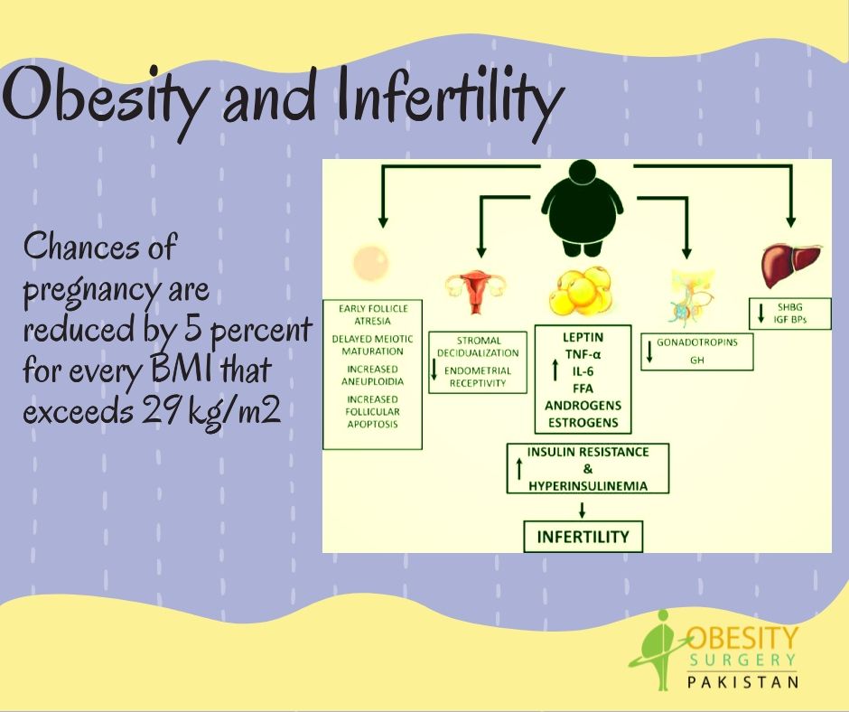 Dr Mirza Arshad Beg on LinkedIn: From PCOs to ovarian failure ,obesity ... Dr Mirza Arshad Beg on LinkedIn: From PCOs to ovarian failure ,obesity ...