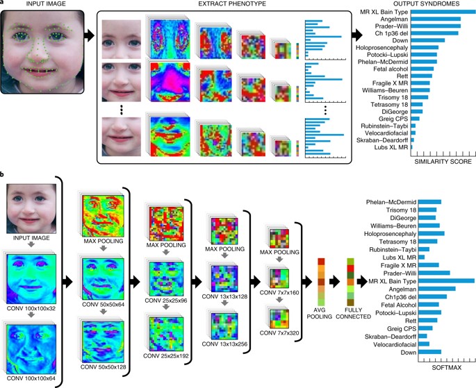 DeepLearning.AI on LinkedIn: Identifying facial phenotypes of genetic ... DeepLearning.AI on LinkedIn: Identifying facial phenotypes of genetic ...