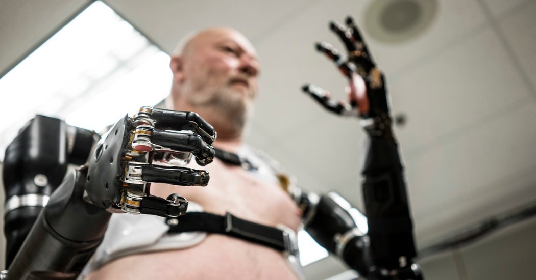 LIM Innovations on LinkedIn: Prosthetic Limbs, Controlled by Thought ... LIM Innovations on LinkedIn: Prosthetic Limbs, Controlled by Thought ...