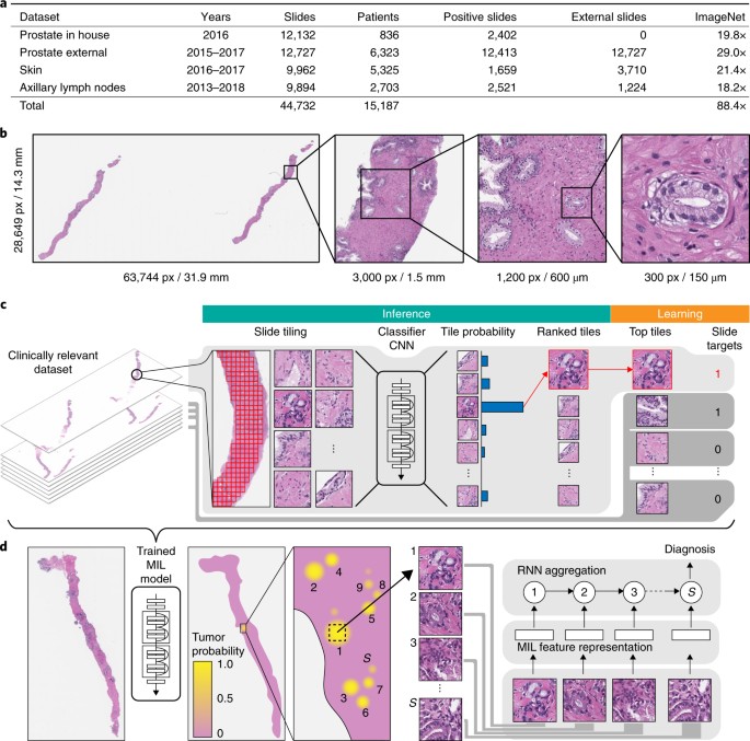 Yonglan Zheng on LinkedIn: Clinical-grade computational pathology using ... Yonglan Zheng on LinkedIn: Clinical-grade computational pathology using ...