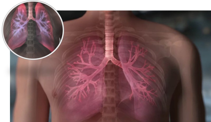 Melissa Herbold on LinkedIn: Outbreak of Lung Injury Associated with ... Melissa Herbold on LinkedIn: Outbreak of Lung Injury Associated with ...