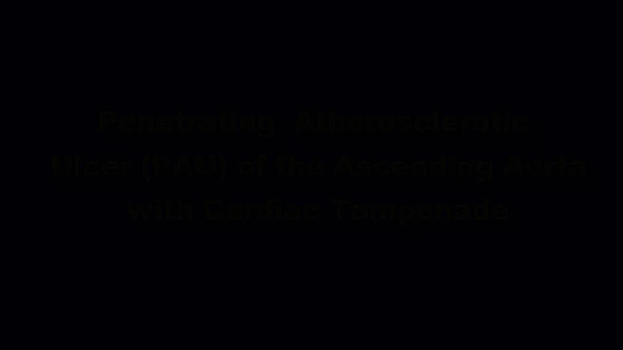 Petar Vukicevic, MD, PhD, Associate Professor on LinkedIn: Penetrating ... Petar Vukicevic, MD, PhD, Associate Professor on LinkedIn: Penetrating ...