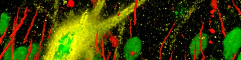 Harald Sontheimer - Harrison Distinguished Professor and Chair ... Harald Sontheimer - Harrison Distinguished Professor and Chair ...