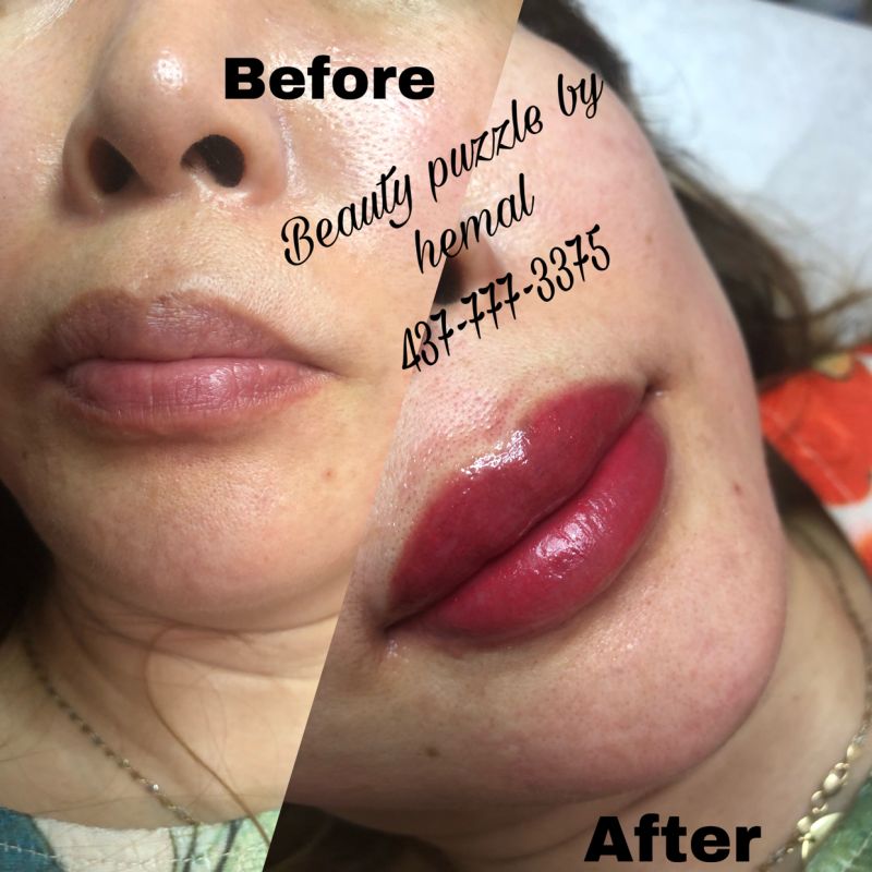 Hemal Parmar on LinkedIn: #lipblush #liptattoo #nurse #cosmeticsindustry Hemal Parmar on LinkedIn: #lipblush #liptattoo #nurse #cosmeticsindustry