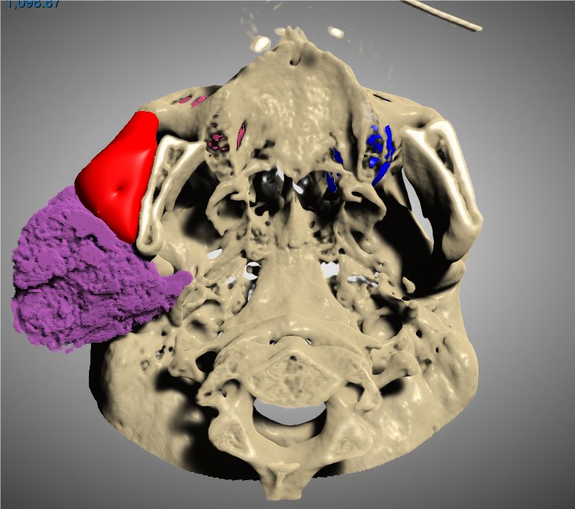 Ahmed Abdelkarim on LinkedIn: #segmentation #anatomy Ahmed Abdelkarim on LinkedIn: #segmentation #anatomy