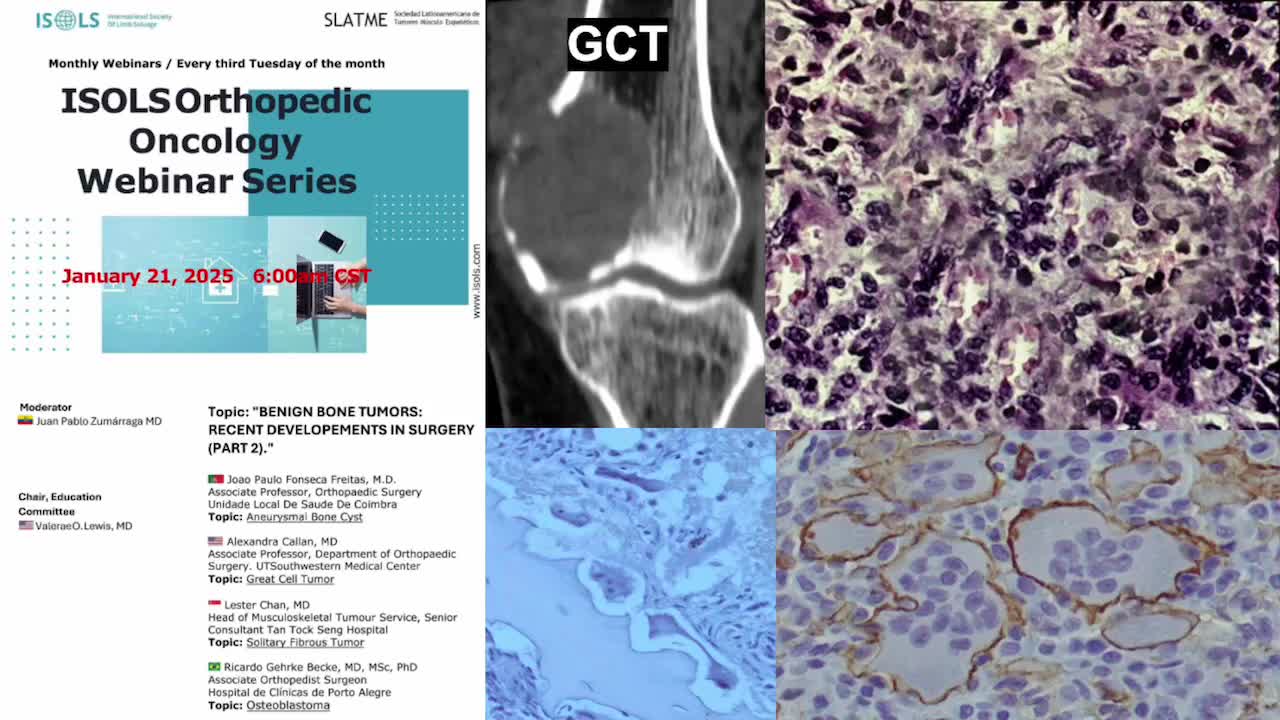 Francis Y. Lee, M.D., Ph.D. on LinkedIn: #interventionalradiology # ... Francis Y. Lee, M.D., Ph.D. on LinkedIn: #interventionalradiology # ...