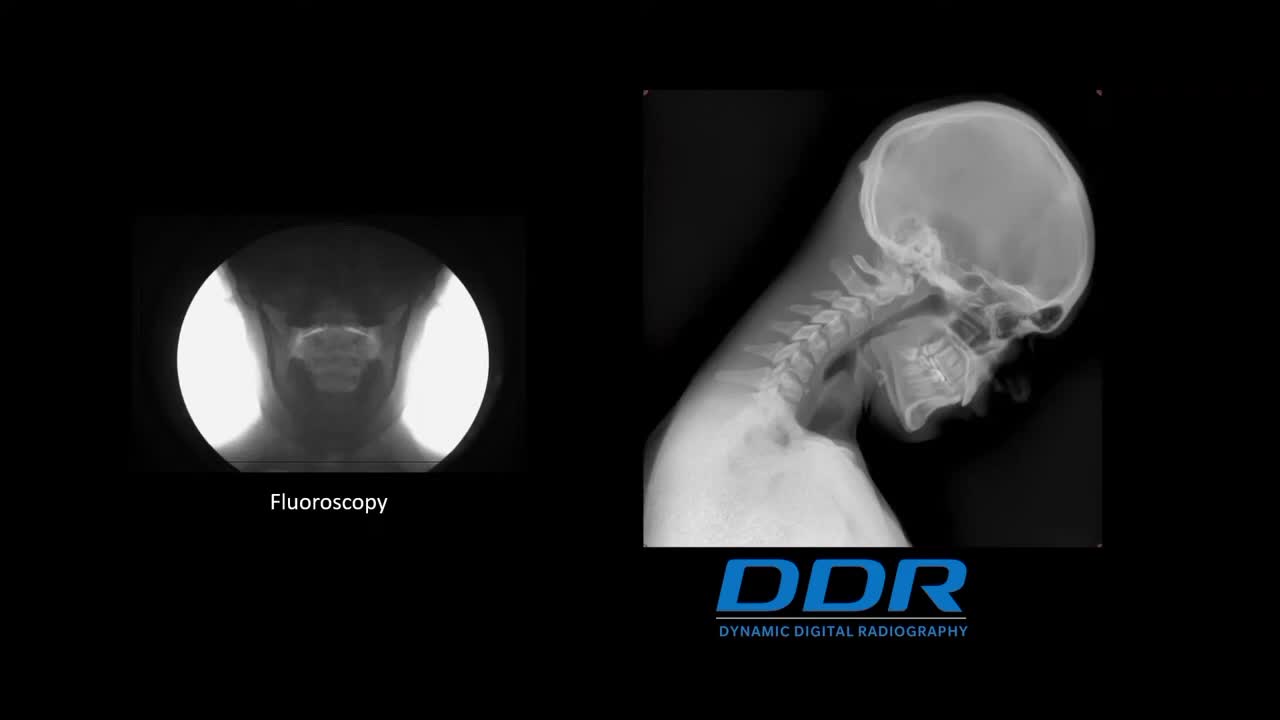 Babar Ali on LinkedIn: X-Ray That Moves! 🖤 Babar Ali Dynamic Digital ... Babar Ali on LinkedIn: X-Ray That Moves! 🖤 Babar Ali Dynamic Digital ...