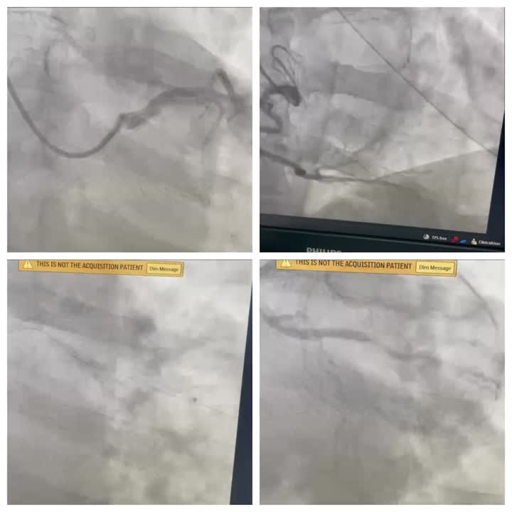 Augusto Daige on LinkedIn: #CATRX Penumbra, Inc. James Reyes, RN Lauren ... Augusto Daige on LinkedIn: #CATRX Penumbra, Inc. James Reyes, RN Lauren ...
