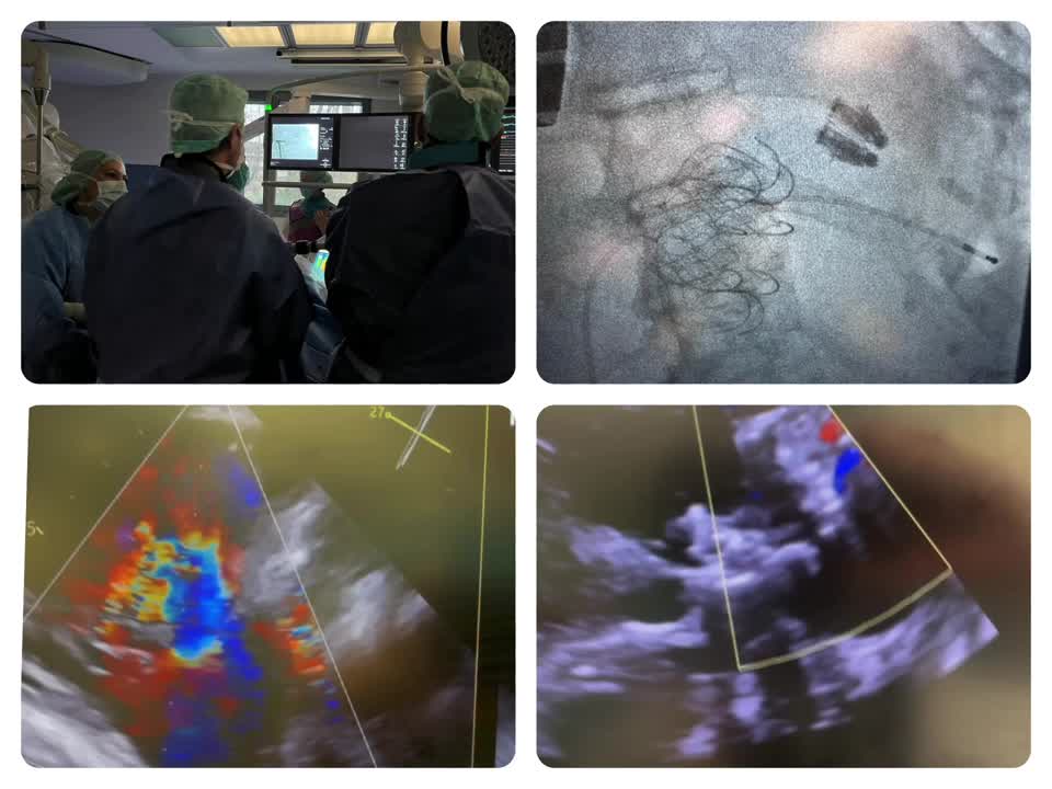 Prof. Dr. Holger Nef on LinkedIn: #teamkardio #xmas #tricuspidvalve # ... Prof. Dr. Holger Nef on LinkedIn: #teamkardio #xmas #tricuspidvalve # ...