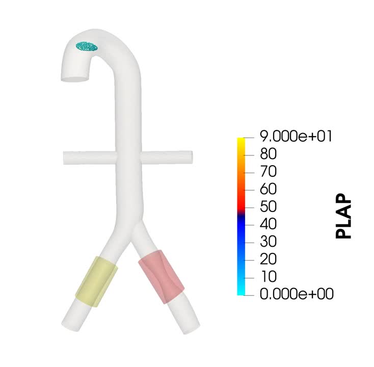 CFD Dose on LinkedIn: Lagrangian Particle Tracking Lagrangian Particle ... CFD Dose on LinkedIn: Lagrangian Particle Tracking Lagrangian Particle ...