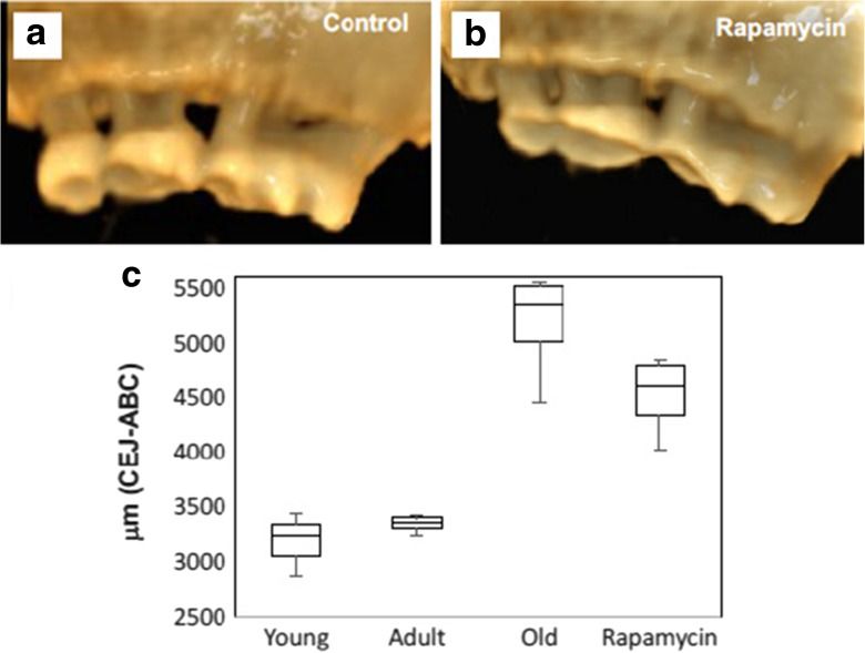 Robert Lufkin MD on LinkedIn: Rapamycin toothpaste? Rapamycin not only ... Robert Lufkin MD on LinkedIn: Rapamycin toothpaste? Rapamycin not only ...