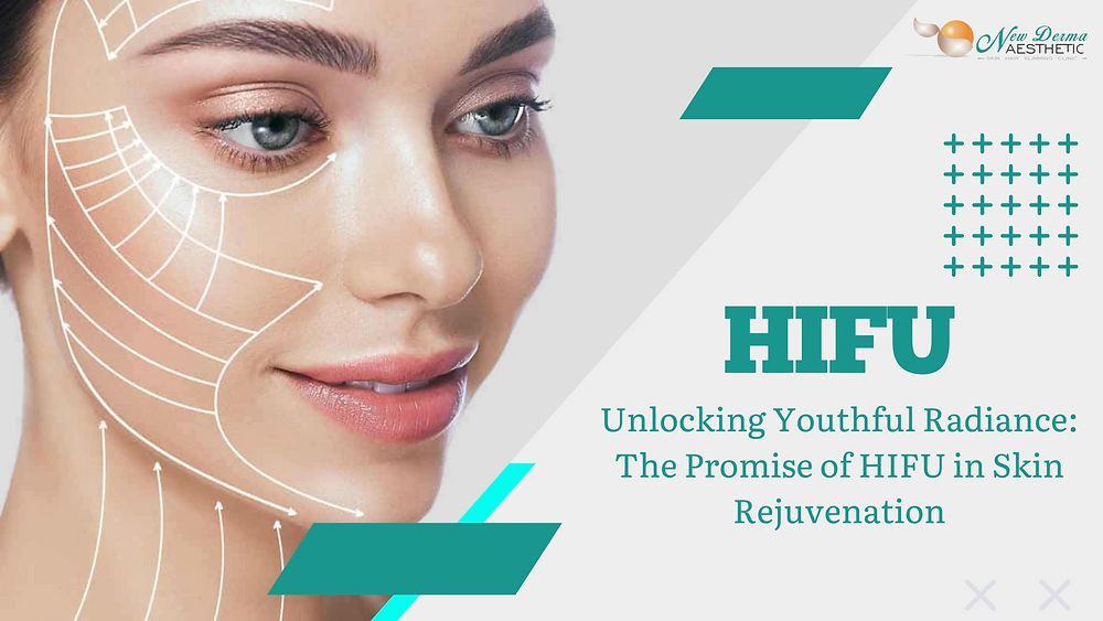 Newderma Aesthetic clinic on LinkedIn: Unlocking Youthful Radiance: The ... Newderma Aesthetic clinic on LinkedIn: Unlocking Youthful Radiance: The ...