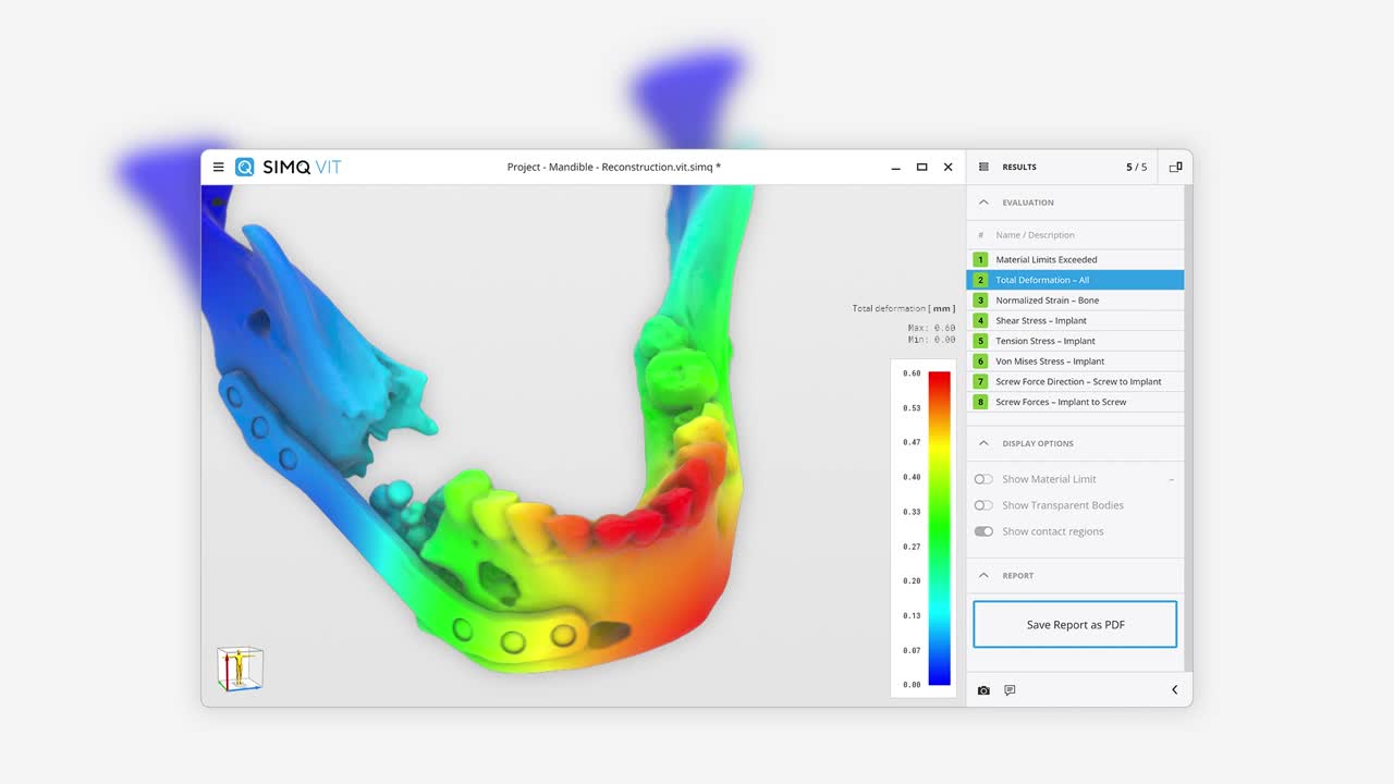 Simq GmbH on LinkedIn: #healthcareinnovation #medicalsimulation # ... Simq GmbH on LinkedIn: #healthcareinnovation #medicalsimulation # ...