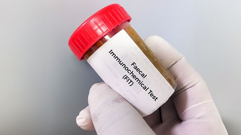 CRC: Next-Generation mt-sDNA Test Beats FIT for Sensitivity | Doctors ... CRC: Next-Generation mt-sDNA Test Beats FIT for Sensitivity | Doctors ...