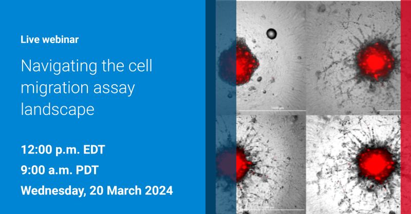 How to optimize image-based cell migration assays | Agilent Cell ... How to optimize image-based cell migration assays | Agilent Cell ...