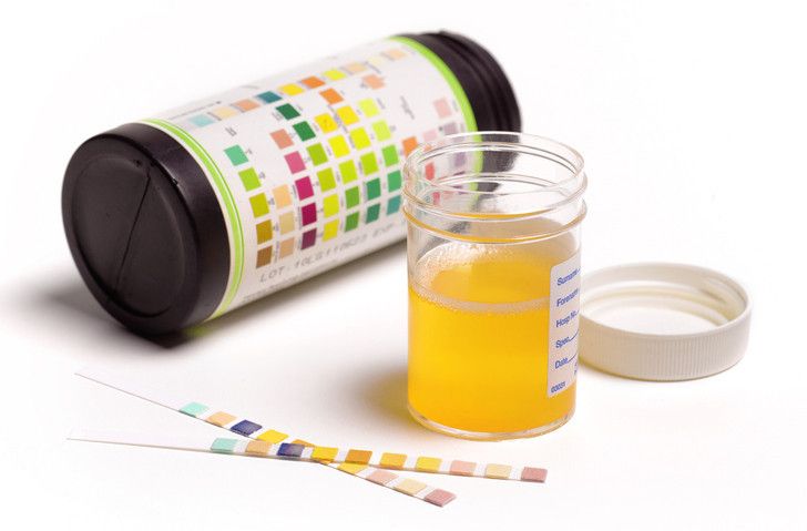 ODRIMEDIA.co.ke on LinkedIn: New Urine Test Could Revolutionize ... ODRIMEDIA.co.ke on LinkedIn: New Urine Test Could Revolutionize ...