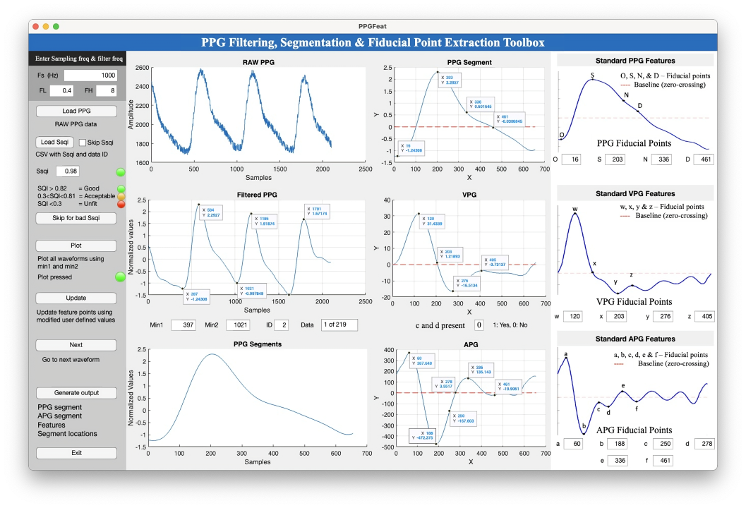 Using MATLAB for Biomedical Signal Processing Using MATLAB for Biomedical Signal Processing