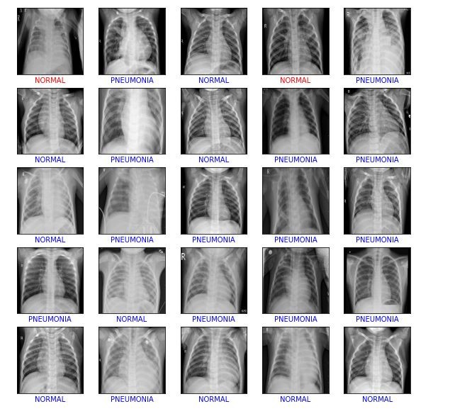 An prove Machine Learning Driven Pneumonia Detection System An prove Machine Learning Driven Pneumonia Detection System