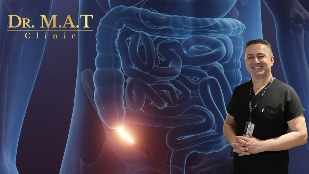 Apandisit Nedir? Nasıl Tedavi Edilir? | Op. Dr. Mehmet Akgün Tepeli Apandisit Nedir? Nasıl Tedavi Edilir? | Op. Dr. Mehmet Akgün Tepeli