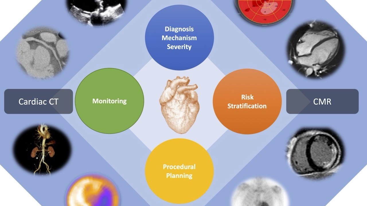 Growth Predictions and Trends for Cardiac Imaging Modalities Growth Predictions and Trends for Cardiac Imaging Modalities