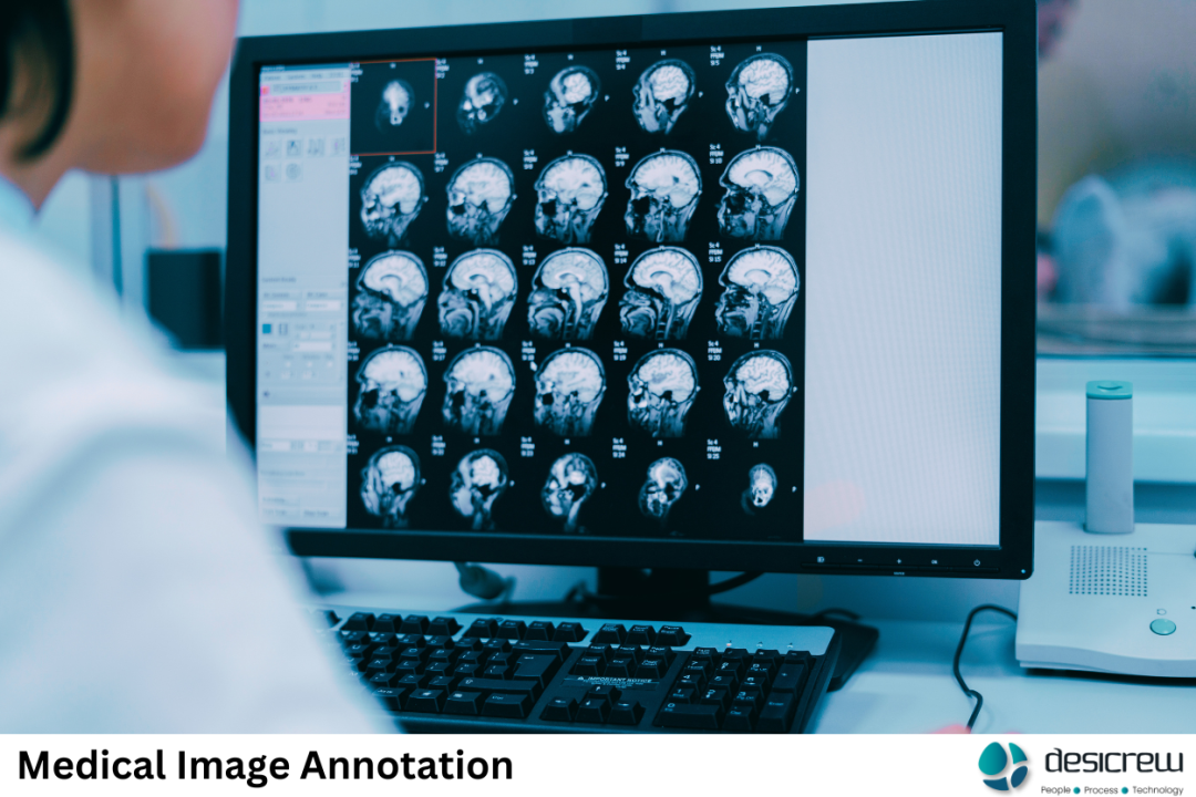 Medical Image Annotation: A Complete Guide Medical Image Annotation: A Complete Guide