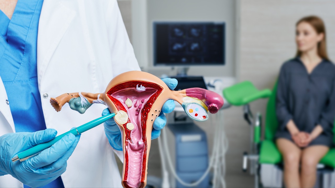 Fibroids: Beyond Surgical Solutions – Exploring Holistic Approaches Fibroids: Beyond Surgical Solutions – Exploring Holistic Approaches