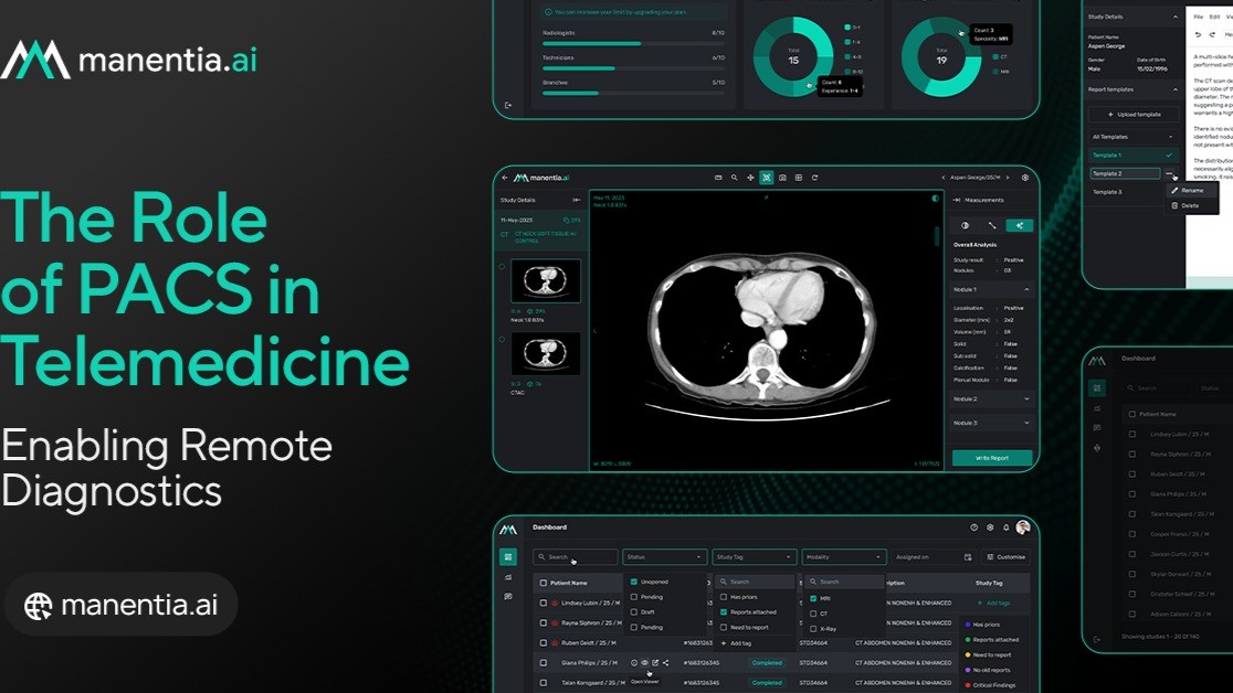 The Role of PACS in Telemedicine: Enabling Remote Diagnostics The Role of PACS in Telemedicine: Enabling Remote Diagnostics