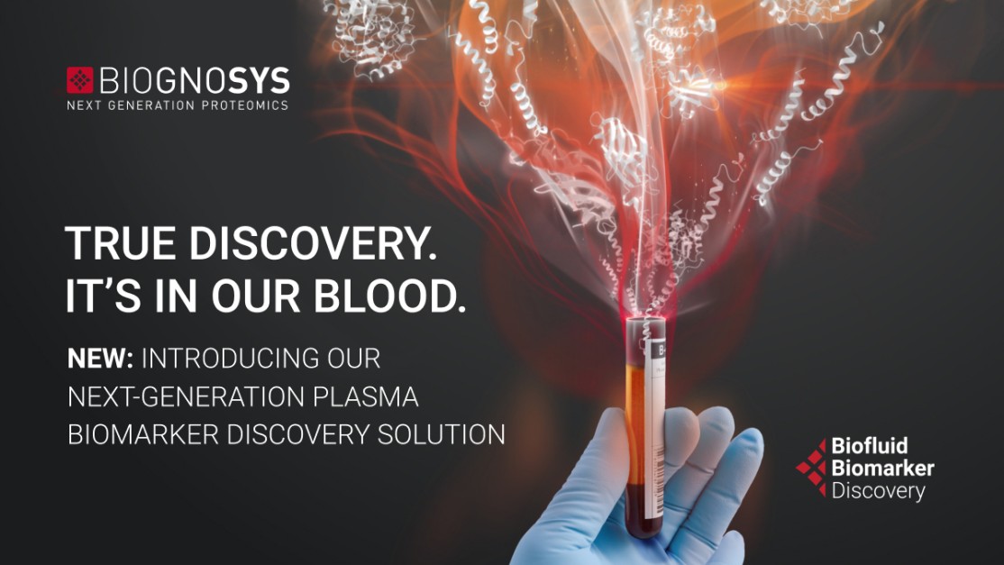Biognosys on LinkedIn: Plasma Biomarker Discovery Biognosys on LinkedIn: Plasma Biomarker Discovery