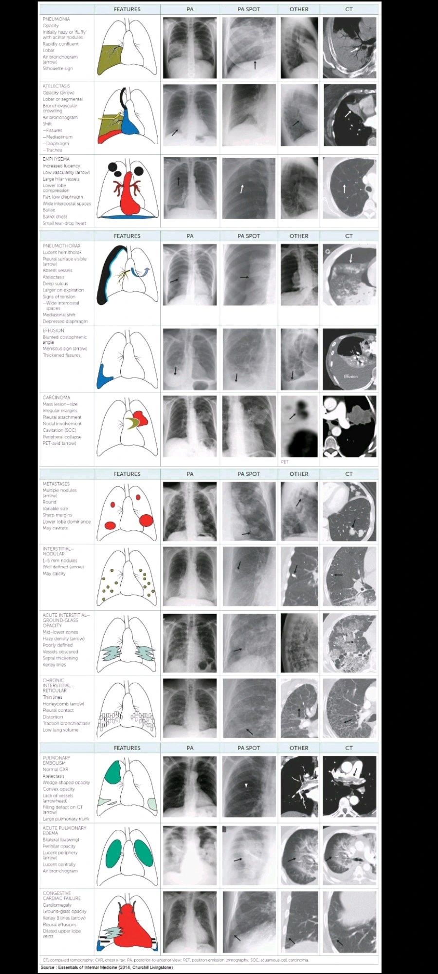 Khawaja Ruman Ahmad on LinkedIn: #radiology #radiologytechnologist # ... Khawaja Ruman Ahmad on LinkedIn: #radiology #radiologytechnologist # ...