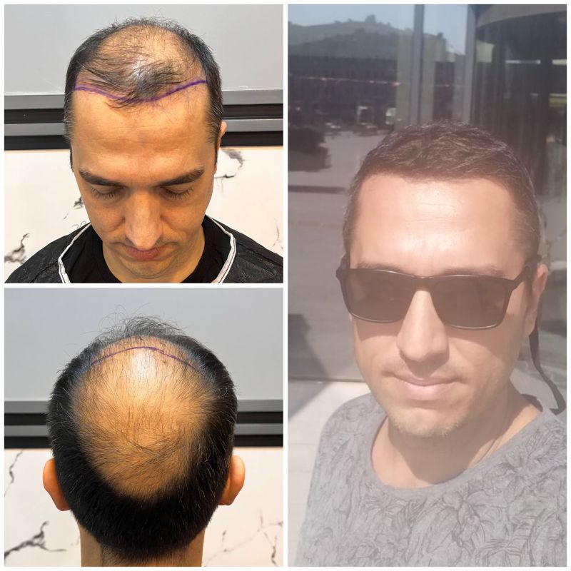 Ali Utku Önel on LinkedIn: 6 months ago, Mr. Barış contacted us for ... Ali Utku Önel on LinkedIn: 6 months ago, Mr. Barış contacted us for ...