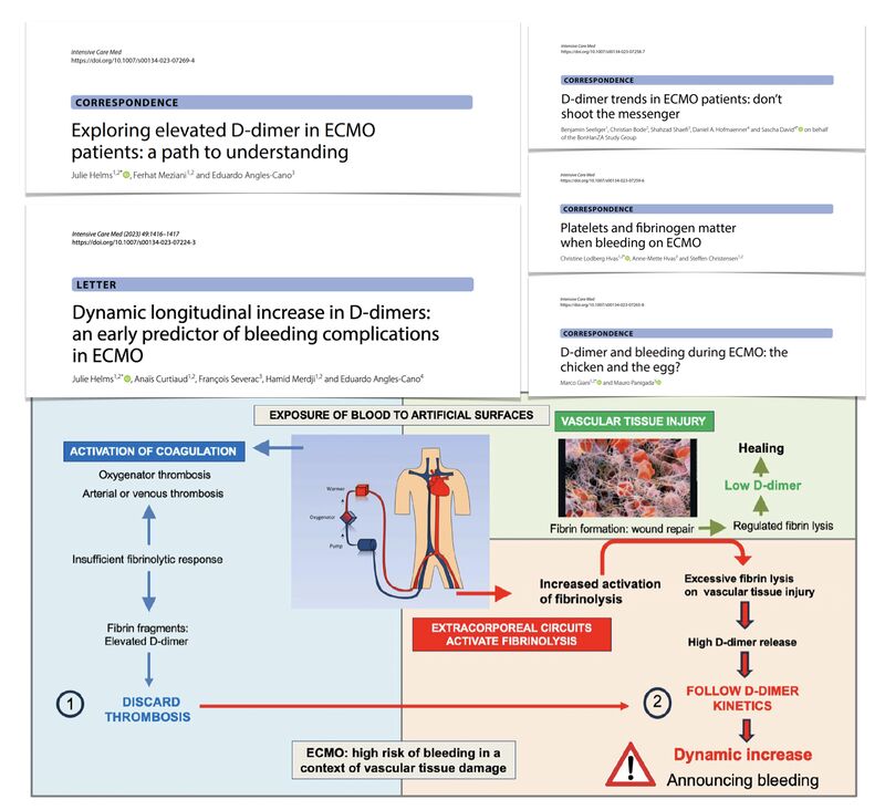 Velia Marta Antonini on LinkedIn: #ecmo #foamcc #foamecmo Velia Marta Antonini on LinkedIn: #ecmo #foamcc #foamecmo