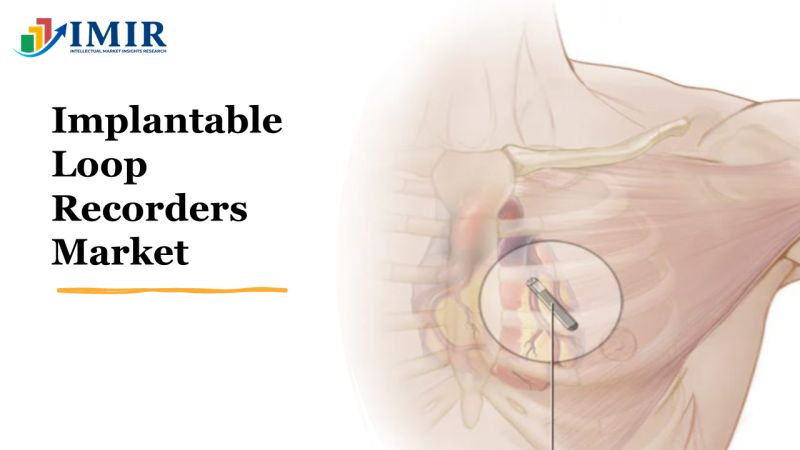 IMIR Market Research Pvt. Ltd. on LinkedIn: Implantable Loop Recorders ... IMIR Market Research Pvt. Ltd. on LinkedIn: Implantable Loop Recorders ...